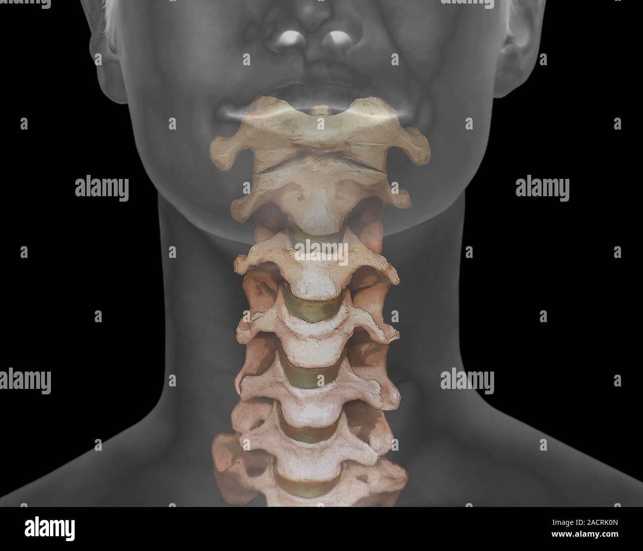 Healthy spine. Coloured 3D computed tomography (CT) scan of the ...