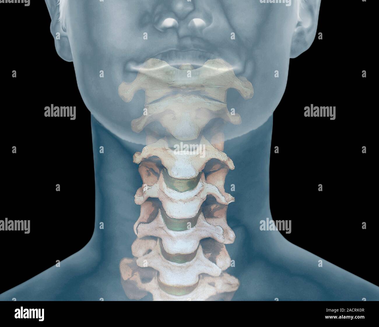 Healthy spine. Coloured 3D computed tomography (CT) scan of the ...