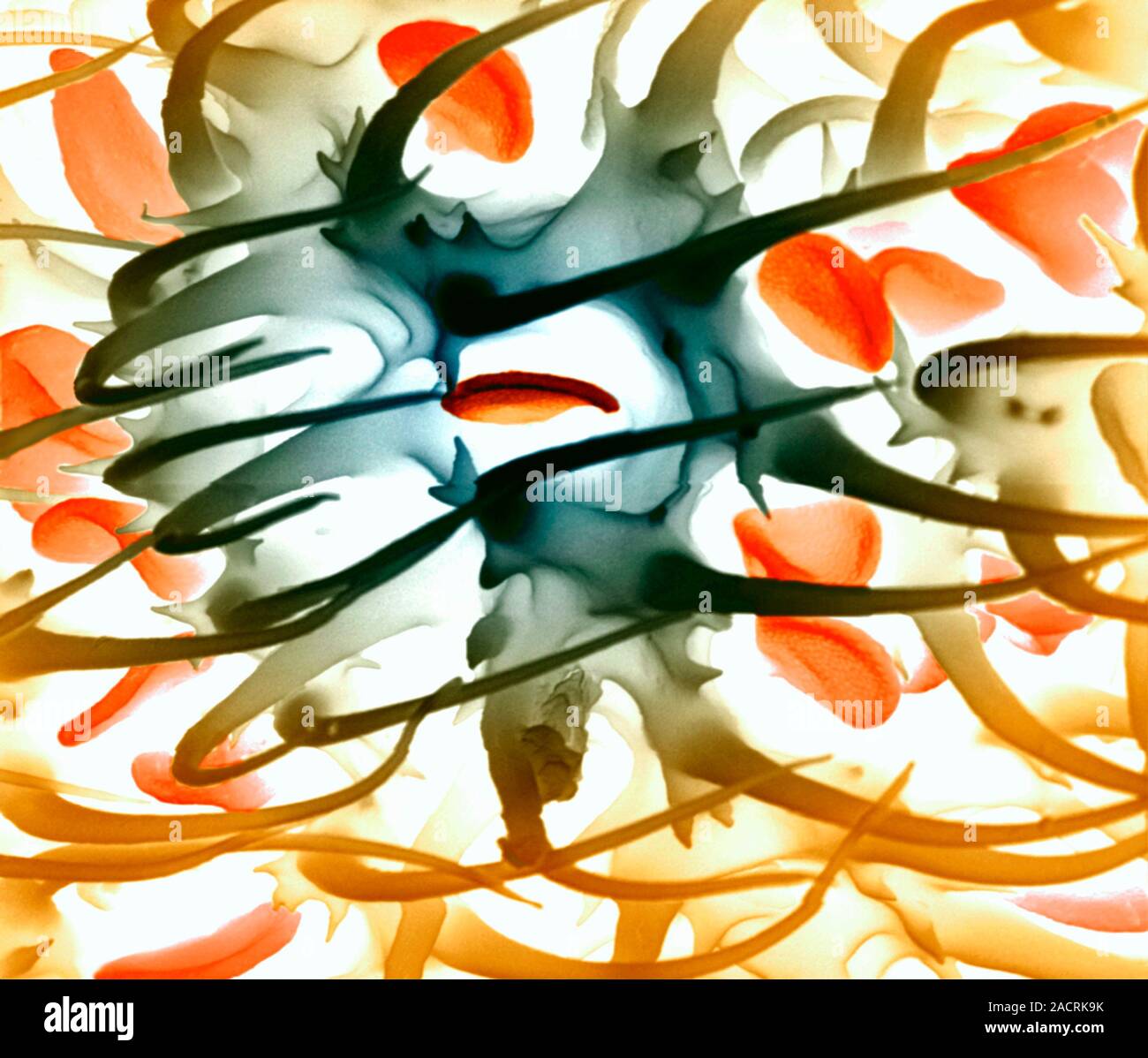 Mosquito antenna, coloured scanning electron micrograph (SEM). The ...