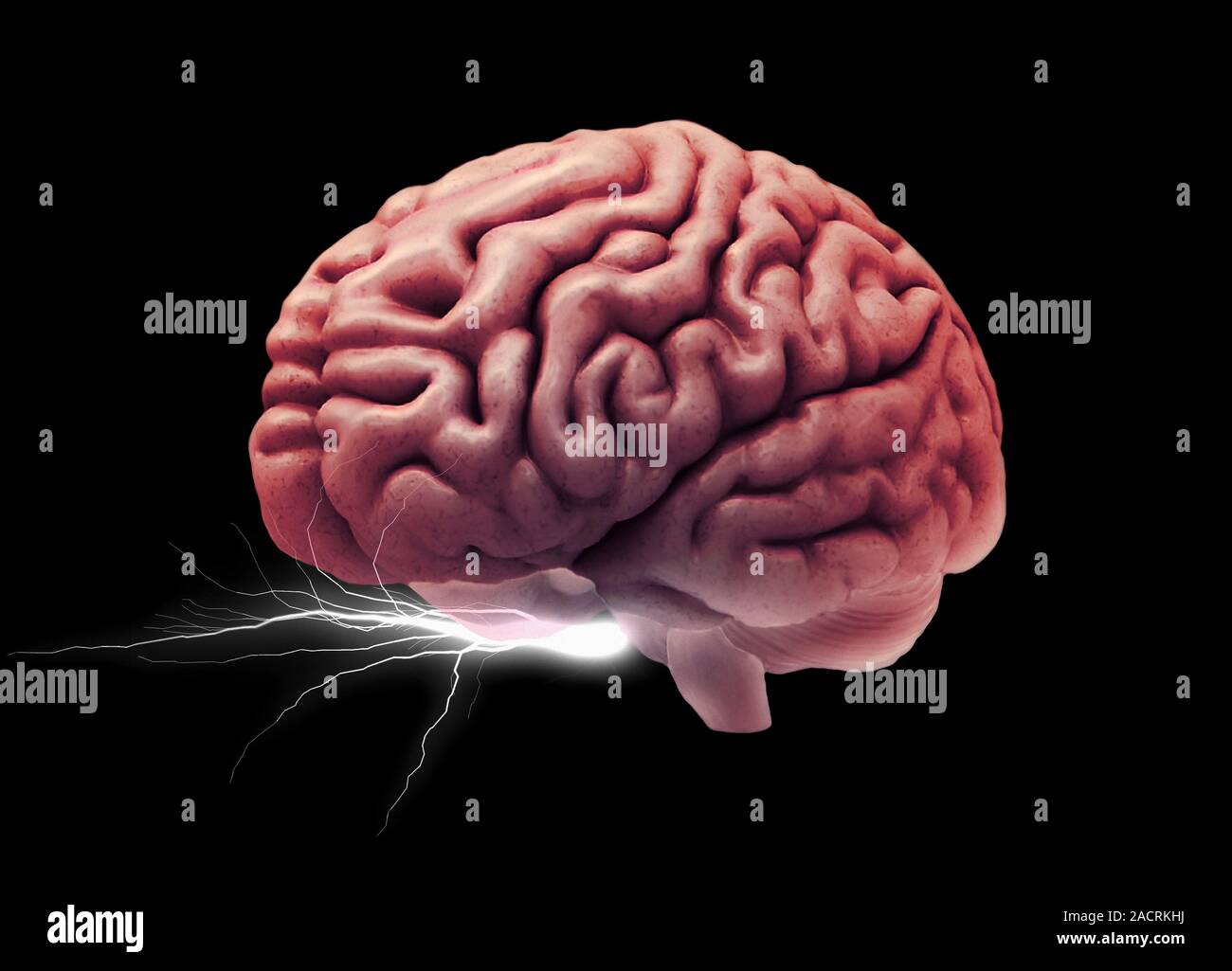 Brain activity, conceptual composite 3D magnetic resonance imaging (MRI ...