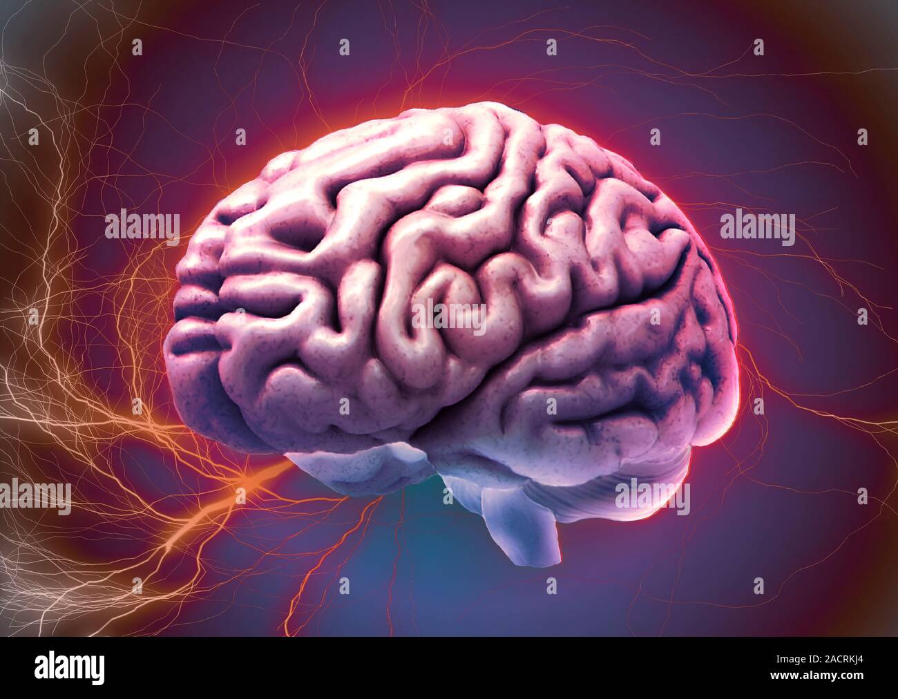 Brain activity, conceptual composite 3D magnetic resonance imaging (MRI ...