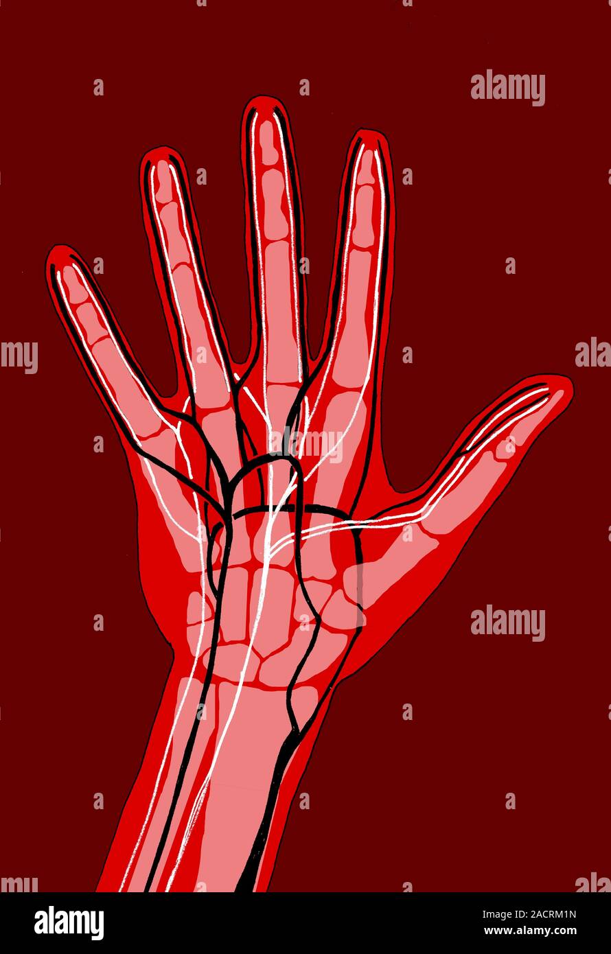 Hand anatomy. Illustration showing the bones, nerves and blood vessels ...