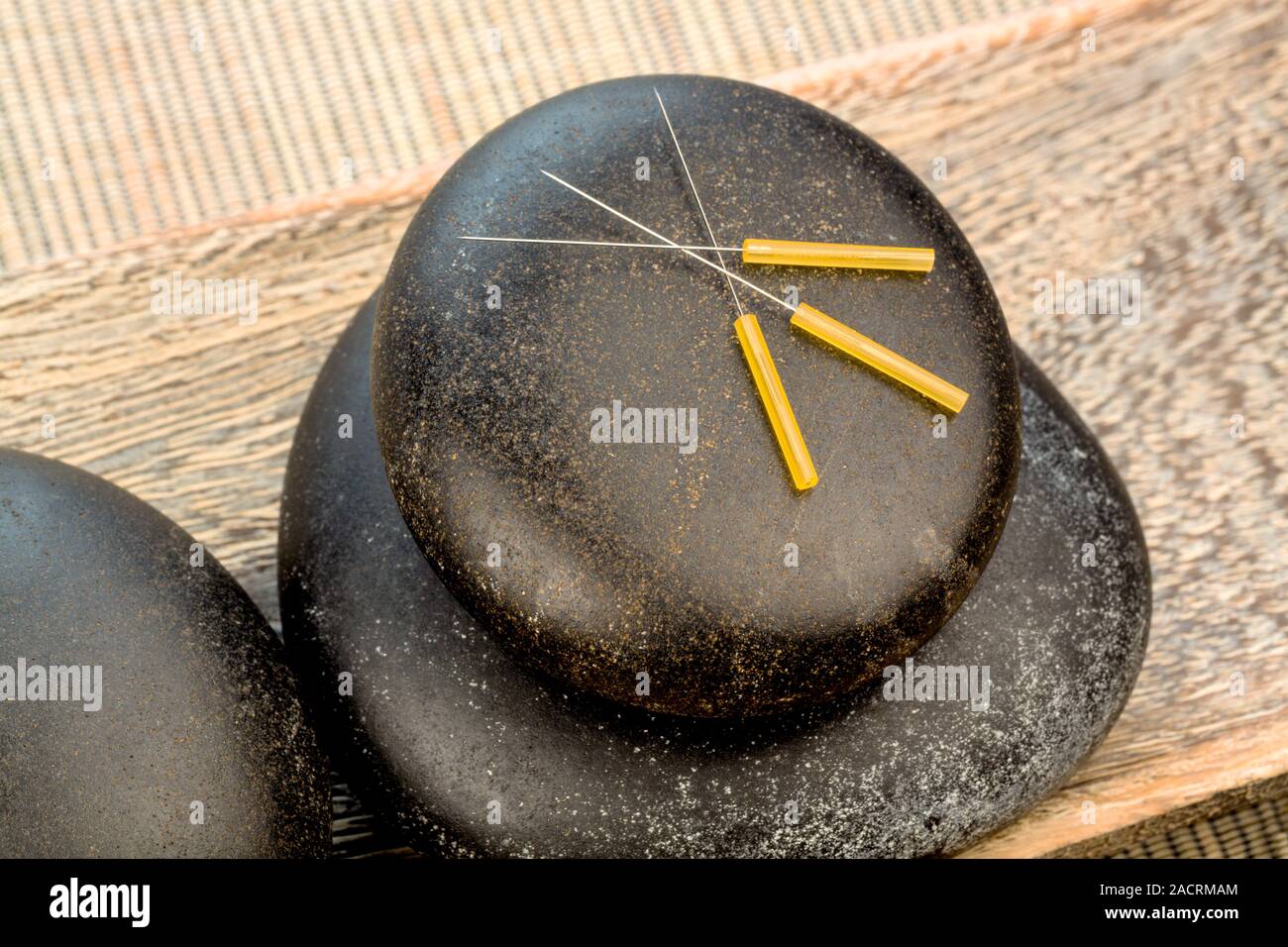 Acupuncture needles tcm hi-res stock photography and images - Alamy