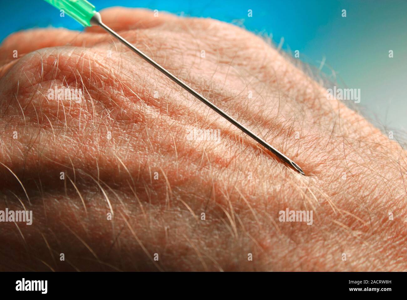 Injection. Needle about to inject a person's hand Stock Photo - Alamy