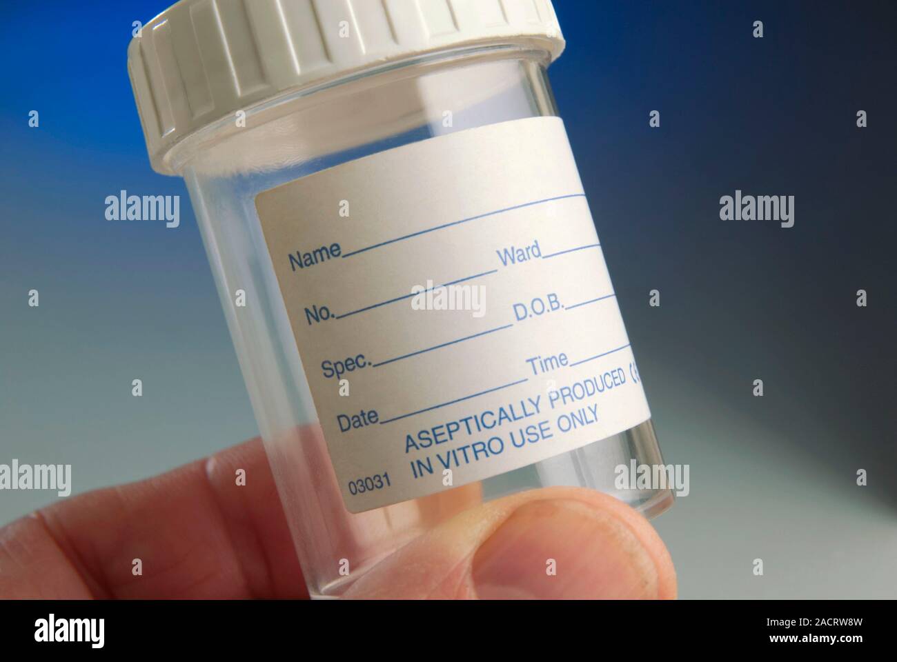 Sample bottle for urine analysis. Analysing urine can be used to ...