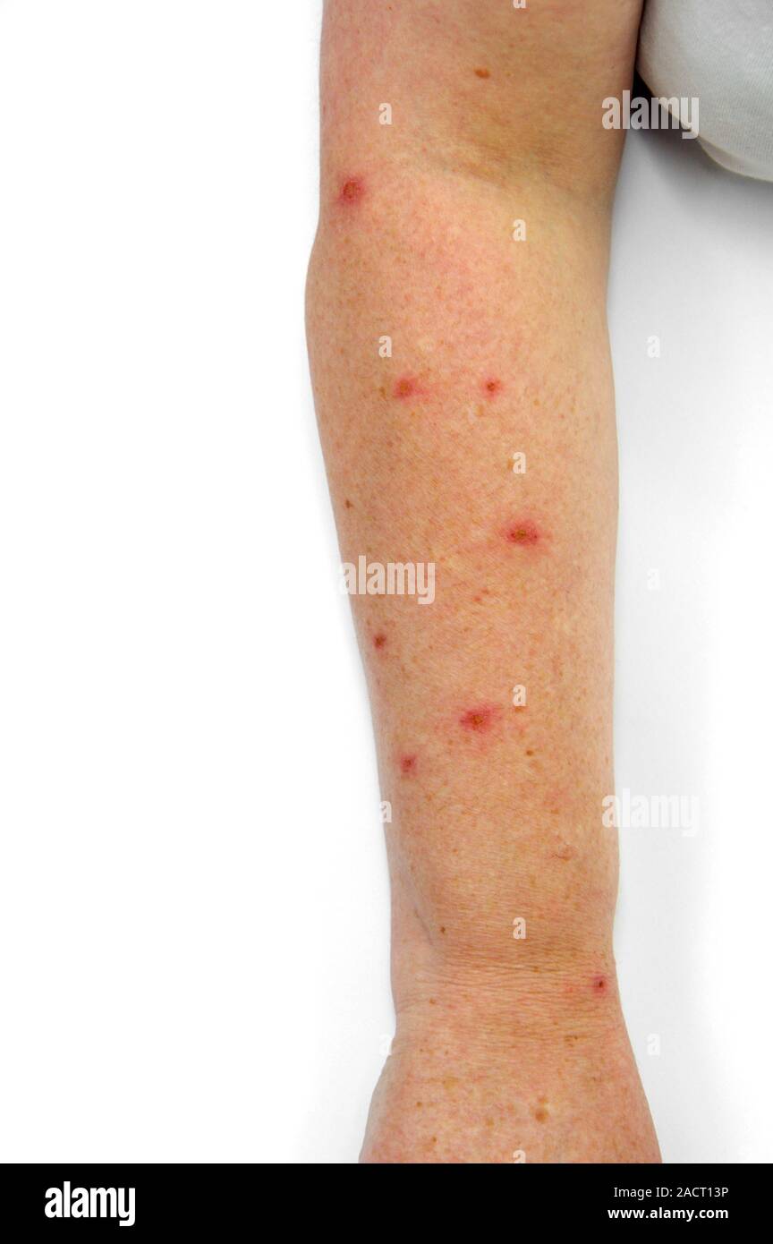 Not for use in Television Not for use in Television Close-up of red ...