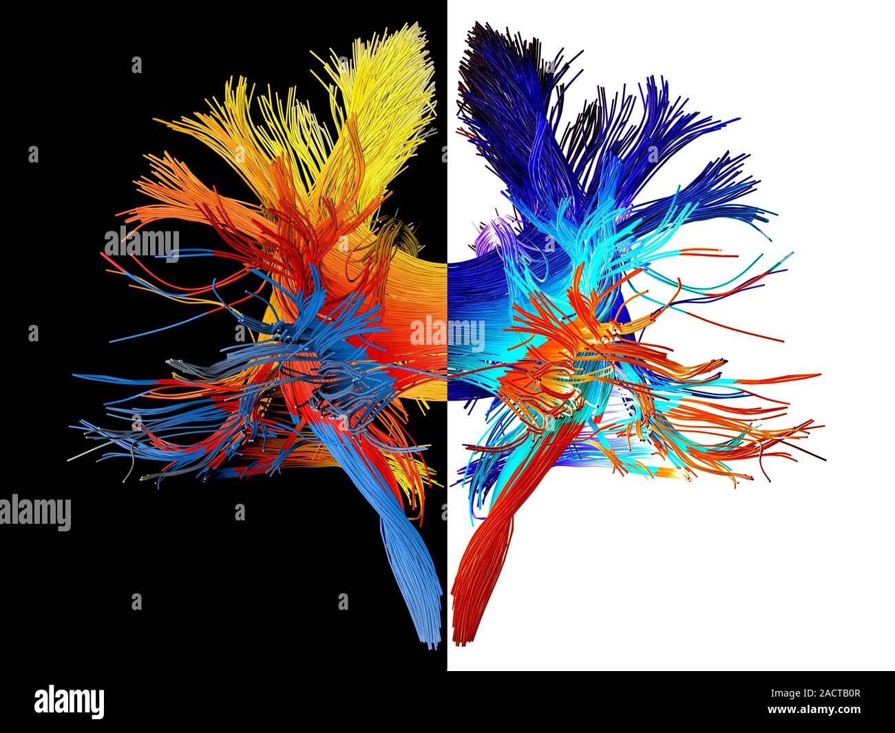 White matter fibres. Computer enhanced 3D diffusion spectral imaging ... White matter fibres. Computer enhanced 3D diffusion spectral imaging ...