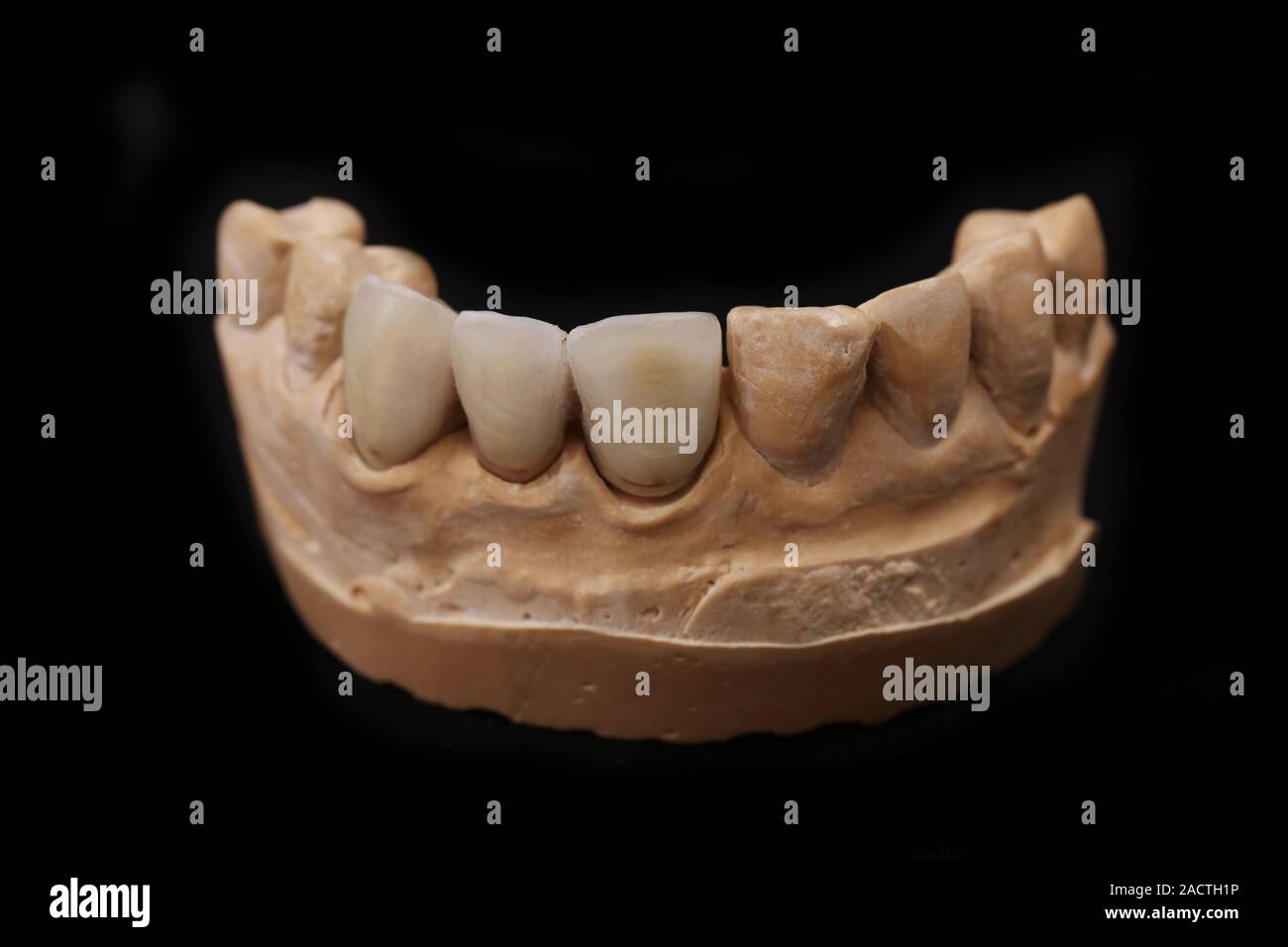 Dental Prothetic laboratory. Technical shots Stock Photo - Alamy