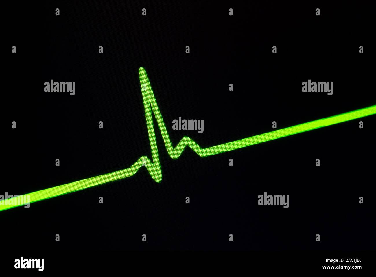 Heartbeat trace. Artwork of the output trace from an electrocardiograph ...