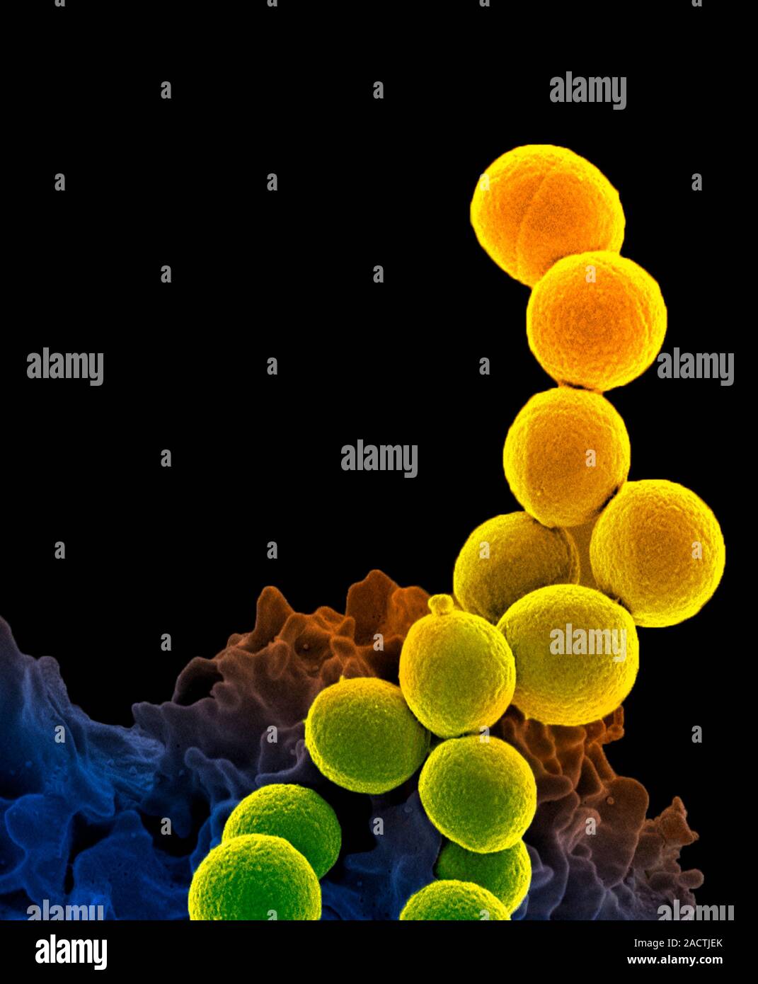 Neutrophil engulfing MRSA. Coloured scanning electron micrograph (SEM ...