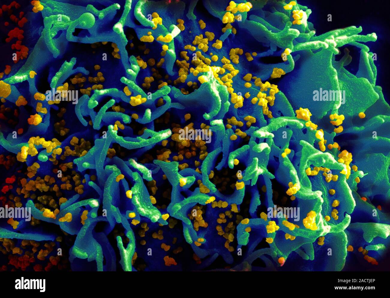 Budding HIV particles. Coloured scanning electron micrograph (SEM) of ...