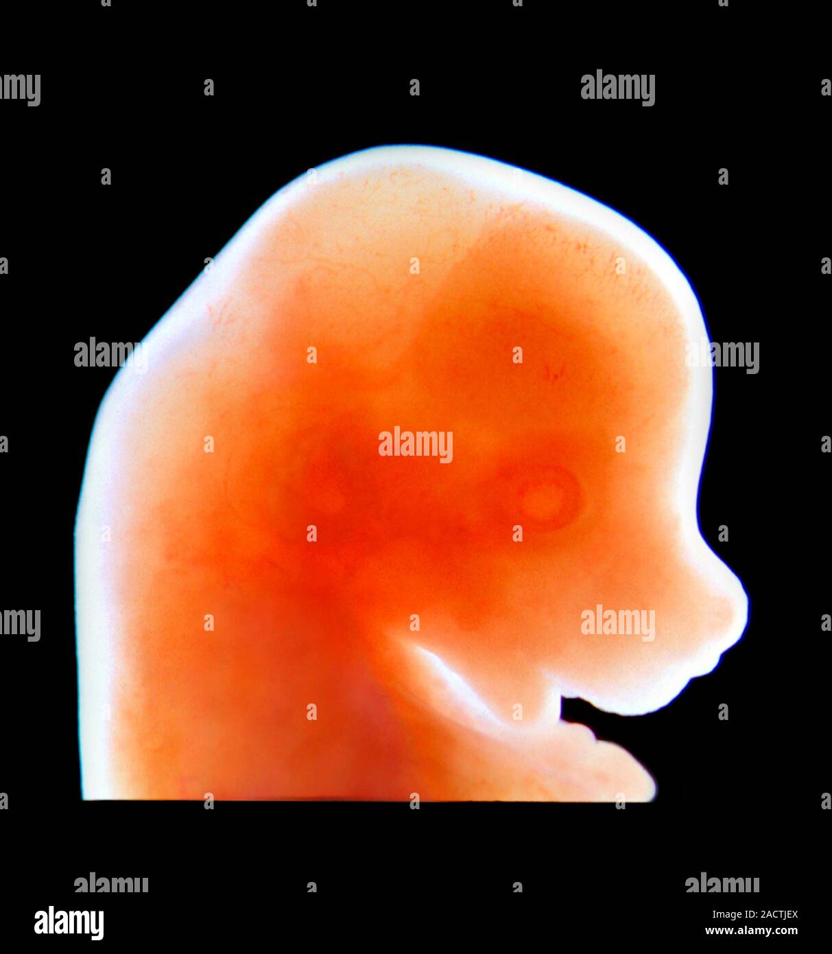 Mouse embryo head. Light micrograph of the head of a mouse (Mus sp ...