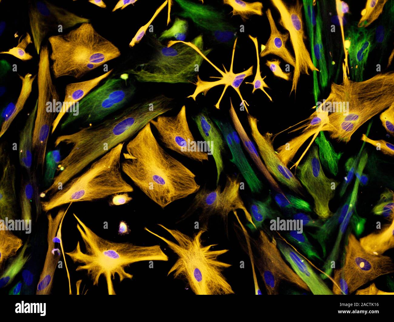 Neural progenitor cell differentiation. Fluorescence light micrograph ...