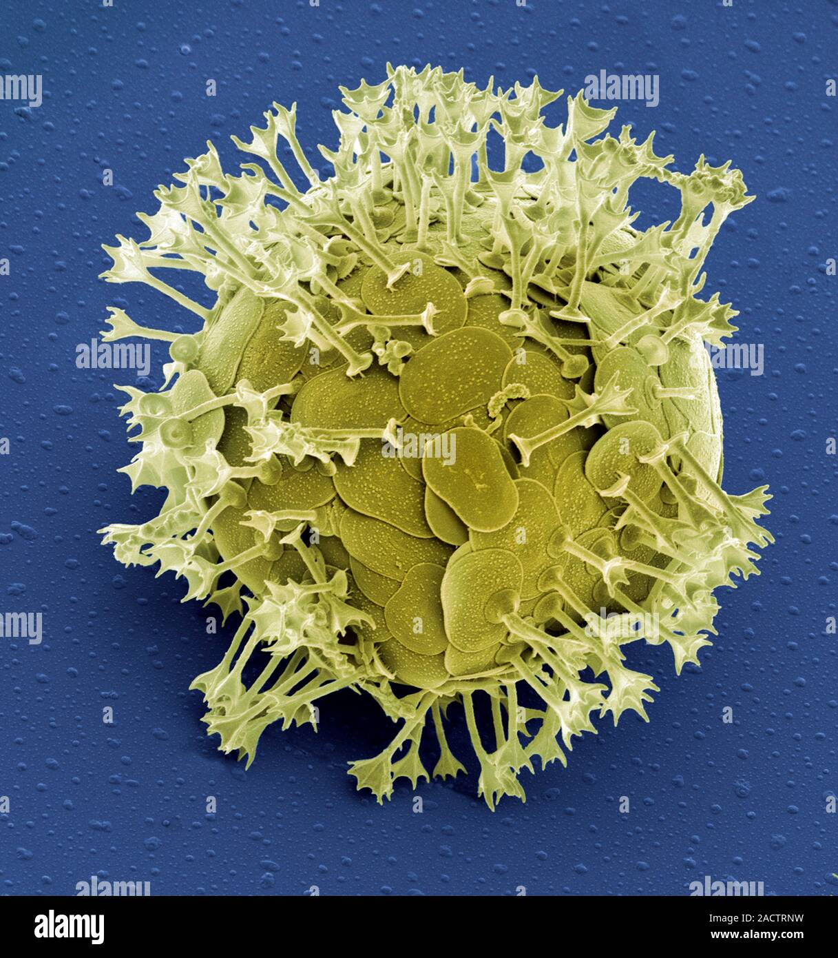 Acanthocystis. Coloured scanning electron micrograph (SEM) of a ...