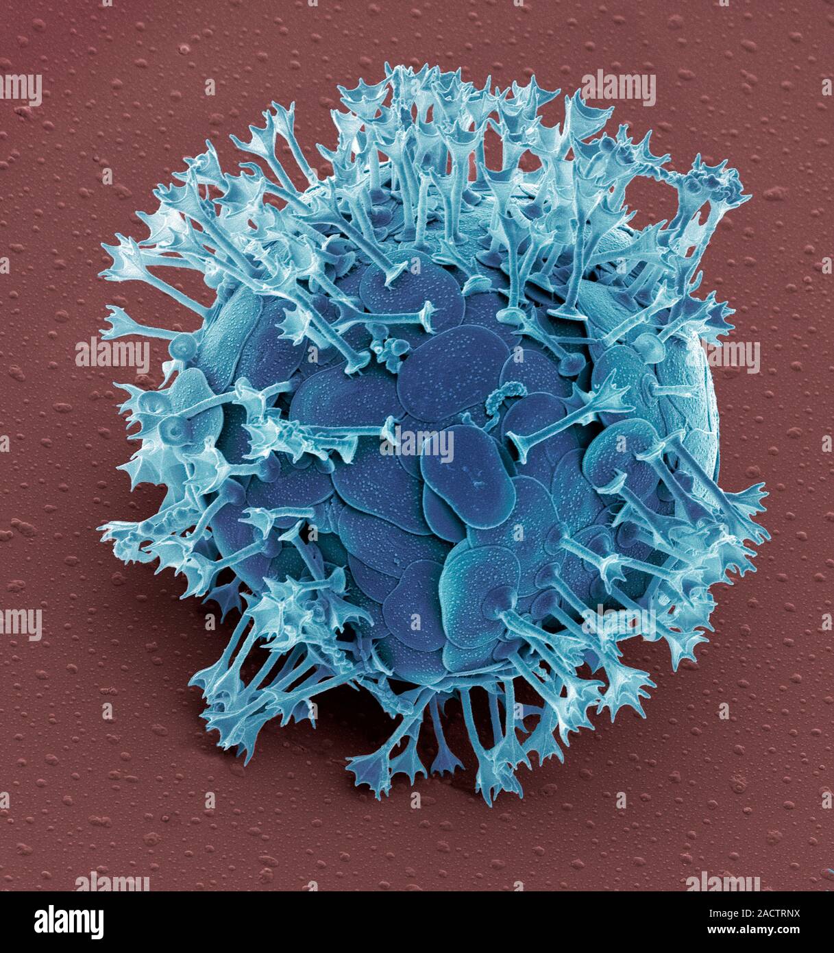 Acanthocystis. Coloured scanning electron micrograph (SEM) of a ...