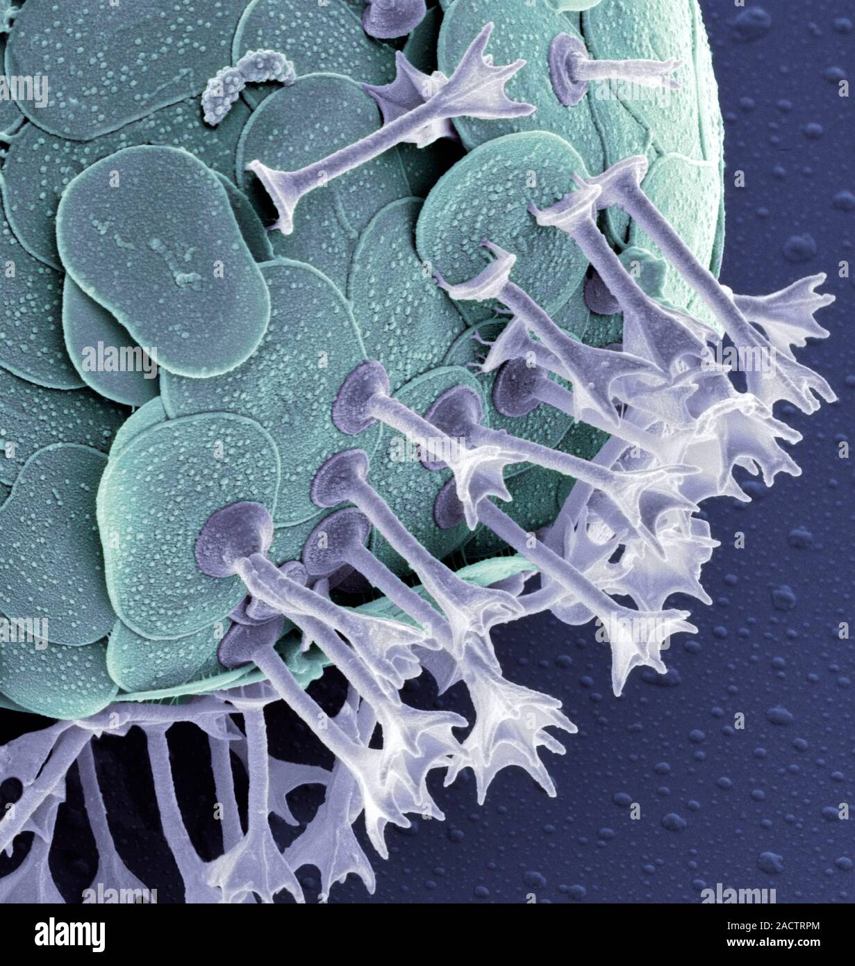 Acanthocystis. Coloured scanning electron micrograph (SEM) of a ...