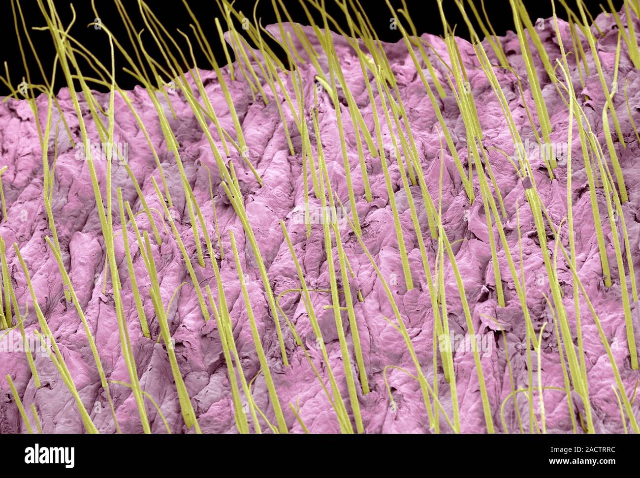 Prenatal hair. Coloured scanning electron micrograph (SEM) of foetal ...