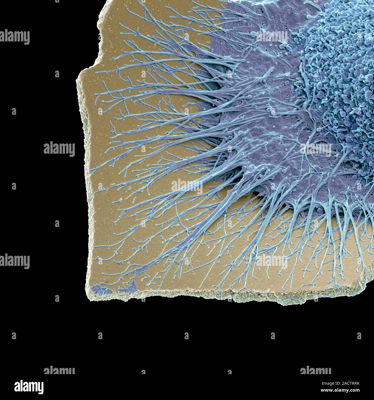 Microglia. Coloured scanning electron micrograph (SEM) of an activated ...