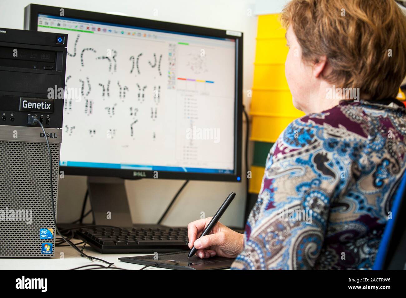 Genetic karyotype analysis. Analyst in a genetics laboratory studying ...