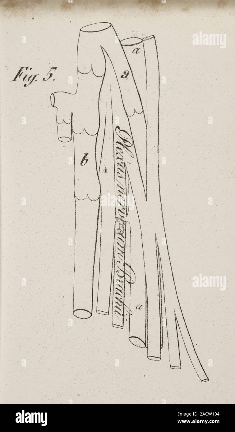 Anatomical drawing, Tendon, Nerve, Blood vessel, Anatomical print of ...