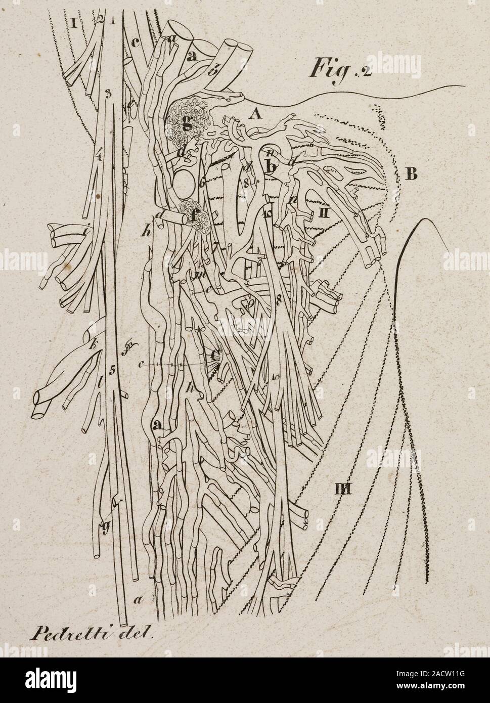 Anatomical drawing, Muscular system, Circulatory system, Anatomical ...