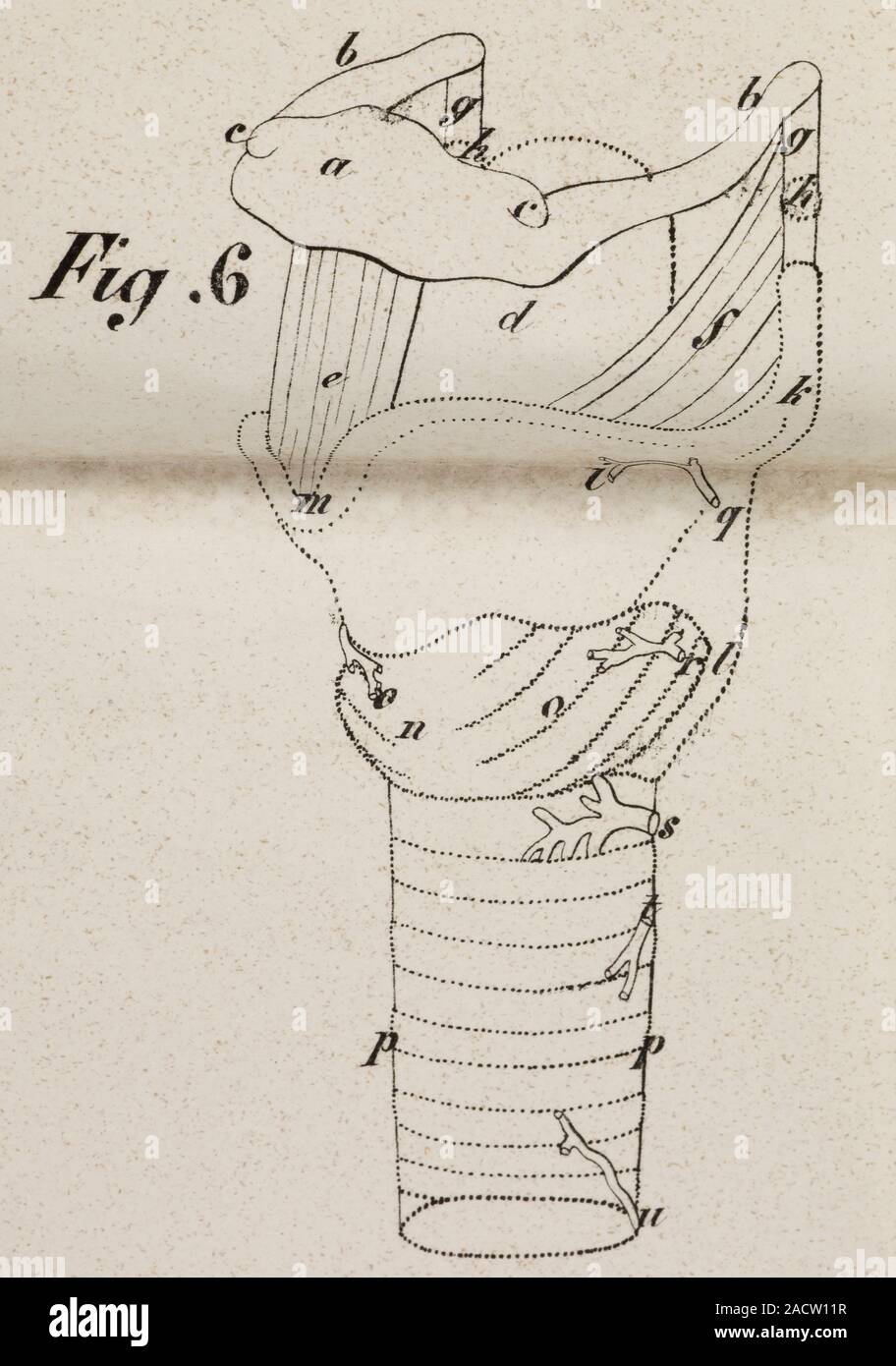 Anatomical drawing, Larynx, Windpipe, Voicebox, Trachea, Anatomical ...