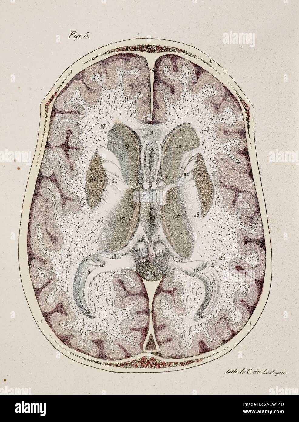 Anatomical drawing, Cross section of the brain, Anatomical print of the ...