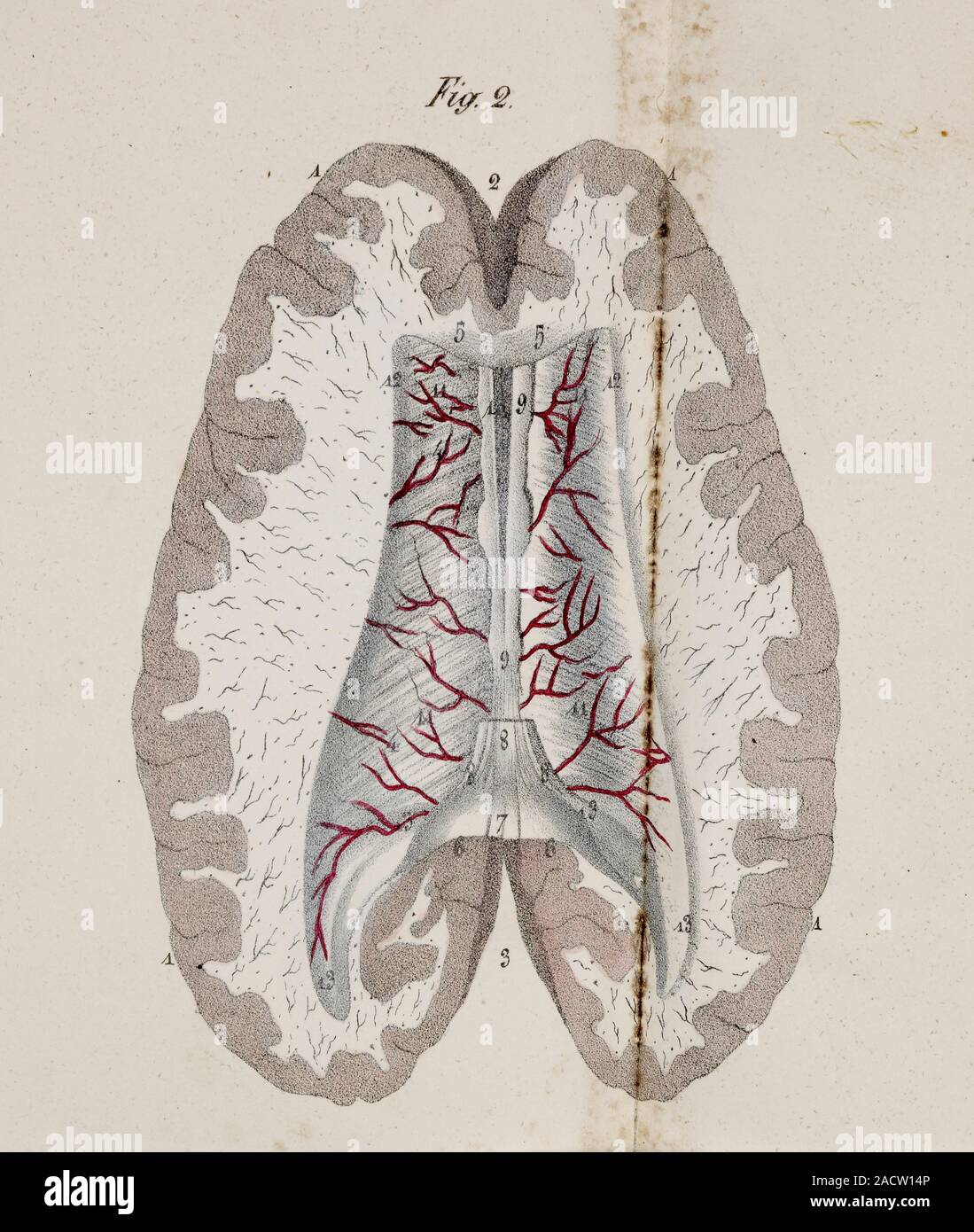Anatomical drawing, Cross section of the brain, Anatomical print of the ...