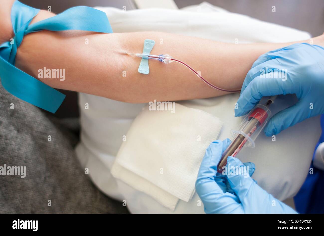 Taking blood sample. Blood sample being taken via a butterfly cannula ...