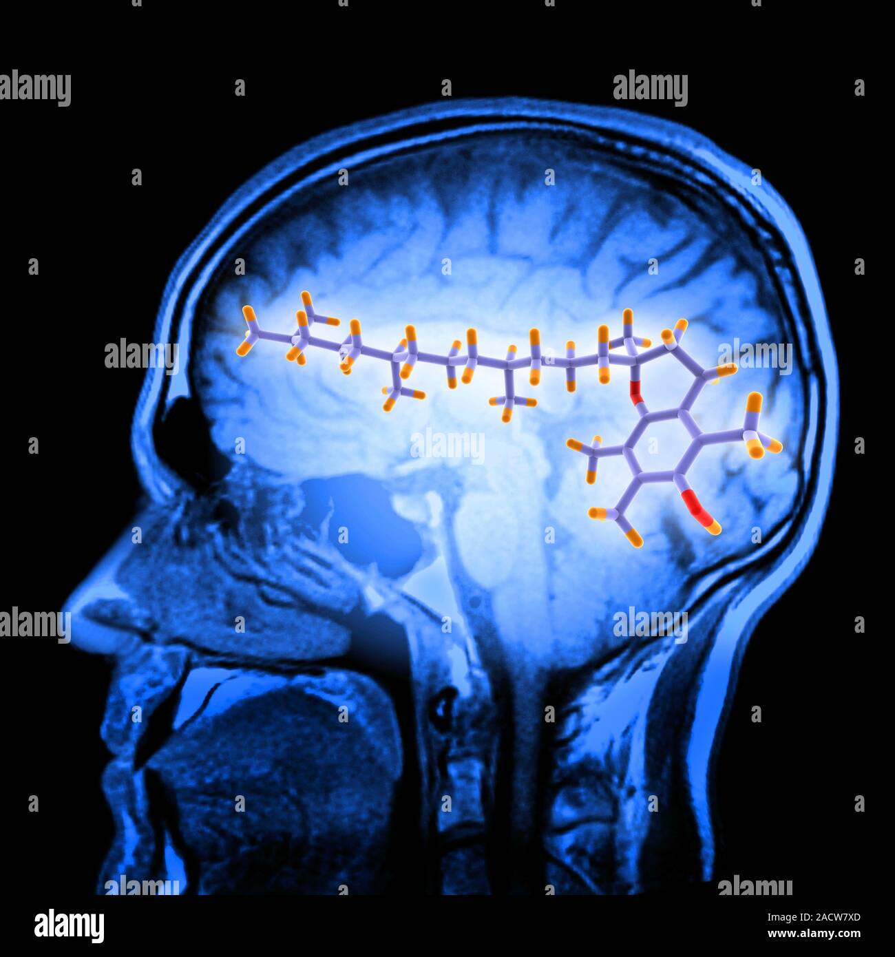 Vitamin E molecule, overlaid a mri scan of the human brain. According ...