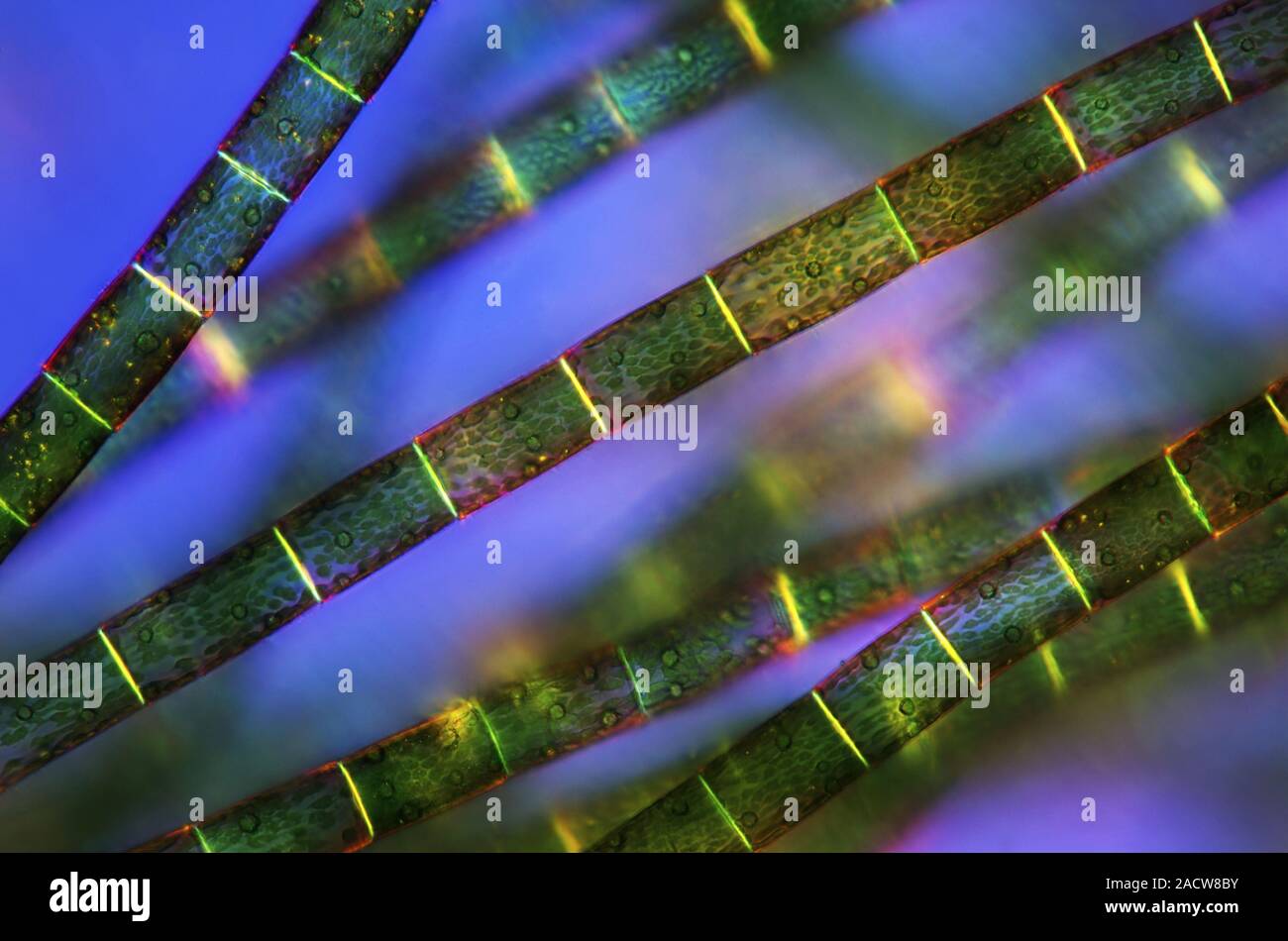 Oedogonium filamentous algae, polarized light micrograph. This alga ...