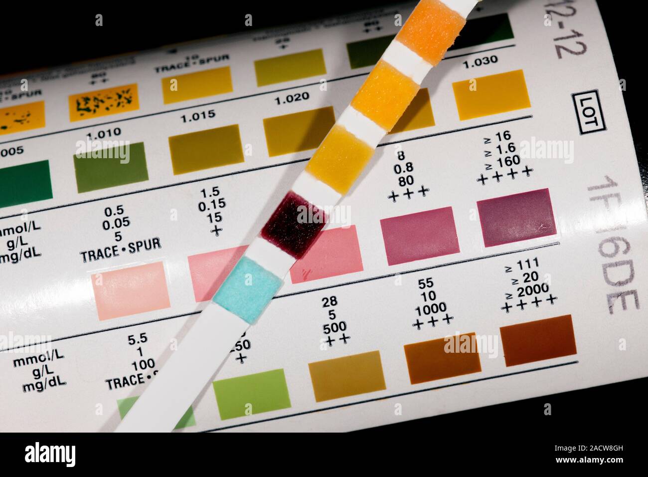 Dipstick test for ketonuria. Close-up of a dipstick and colour chart ...
