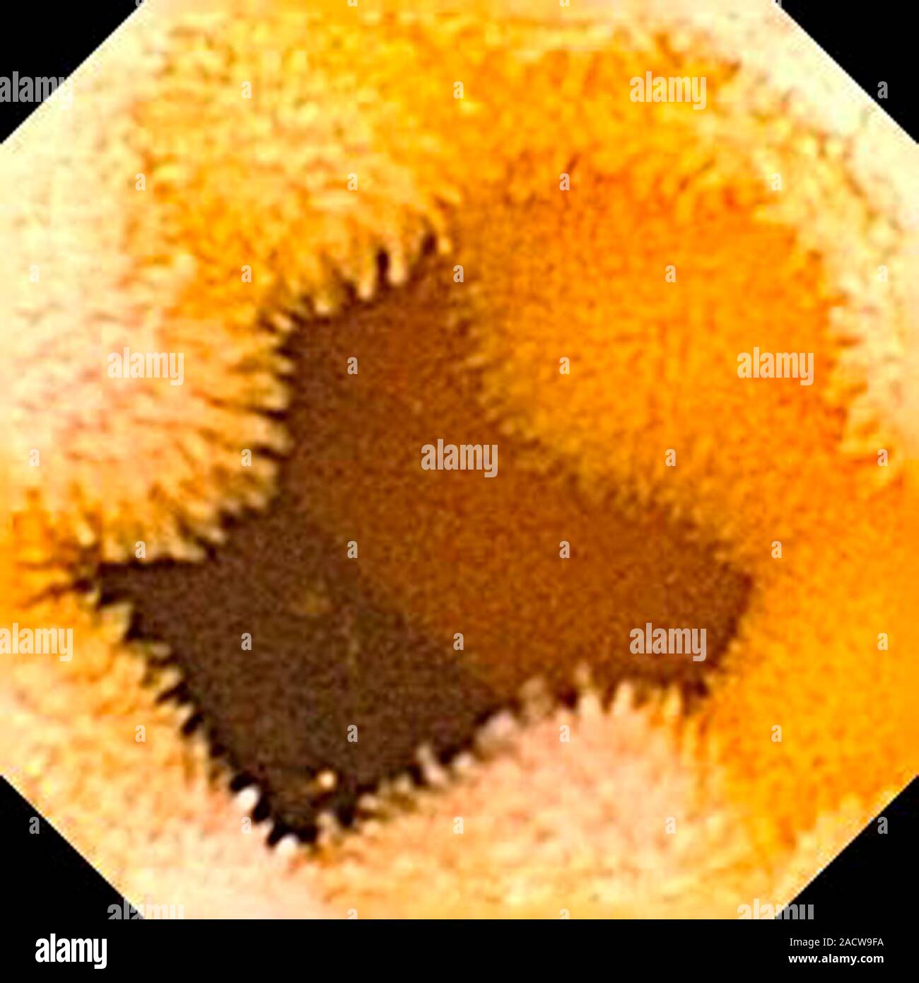 Small intestine, pill camera view. Normal small bowel mucosa with the ...