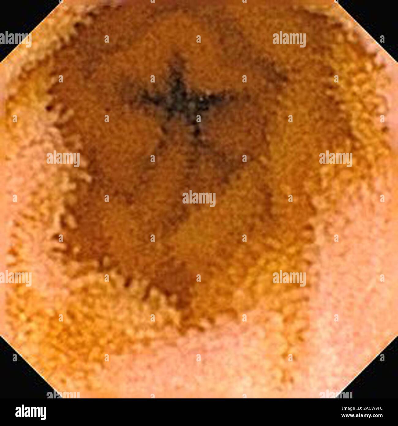 Small intestine, pill camera view. Normal small bowel mucosa with the ...