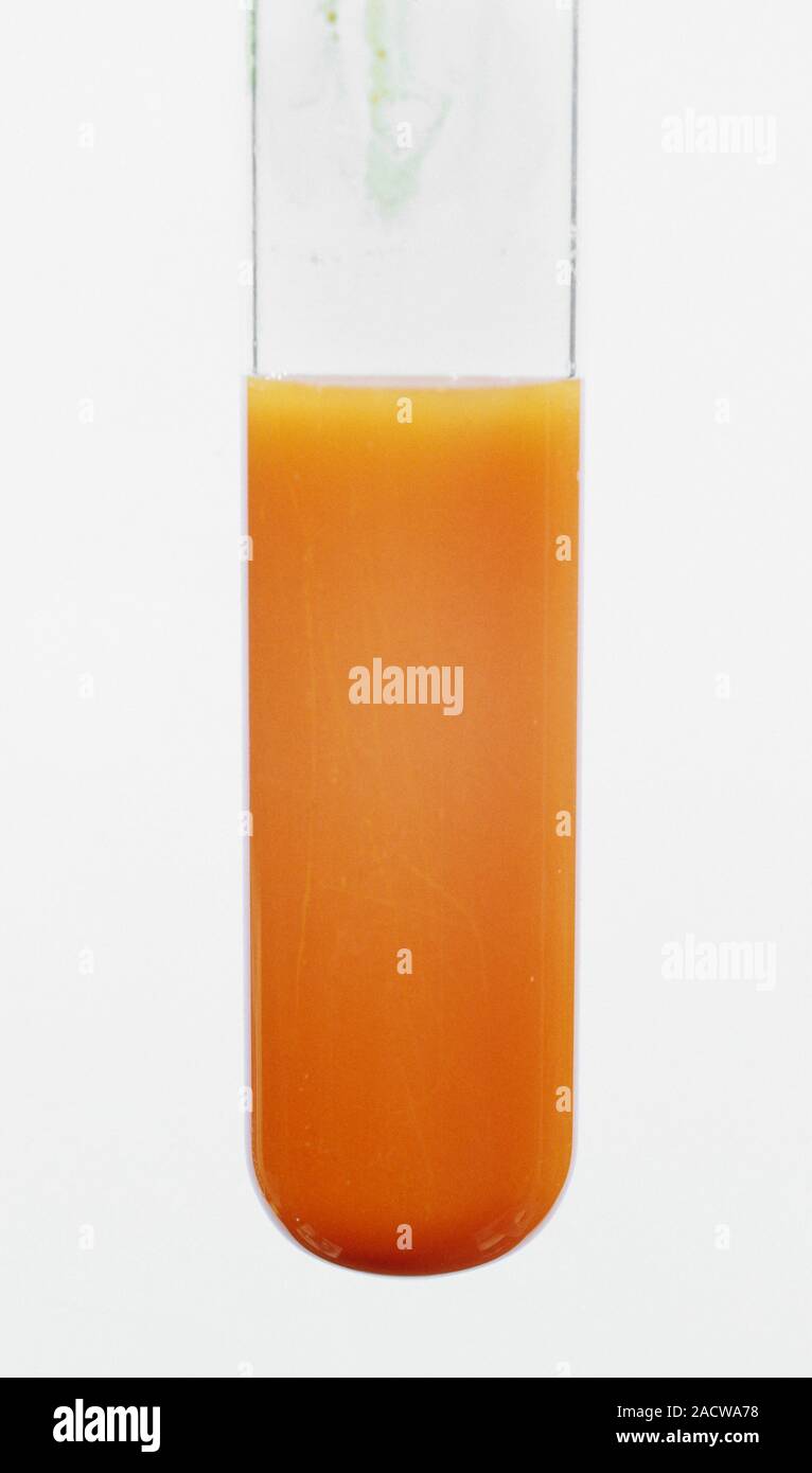 Benedict's test for sugars. Benedict's reagent is a solution of copper ...