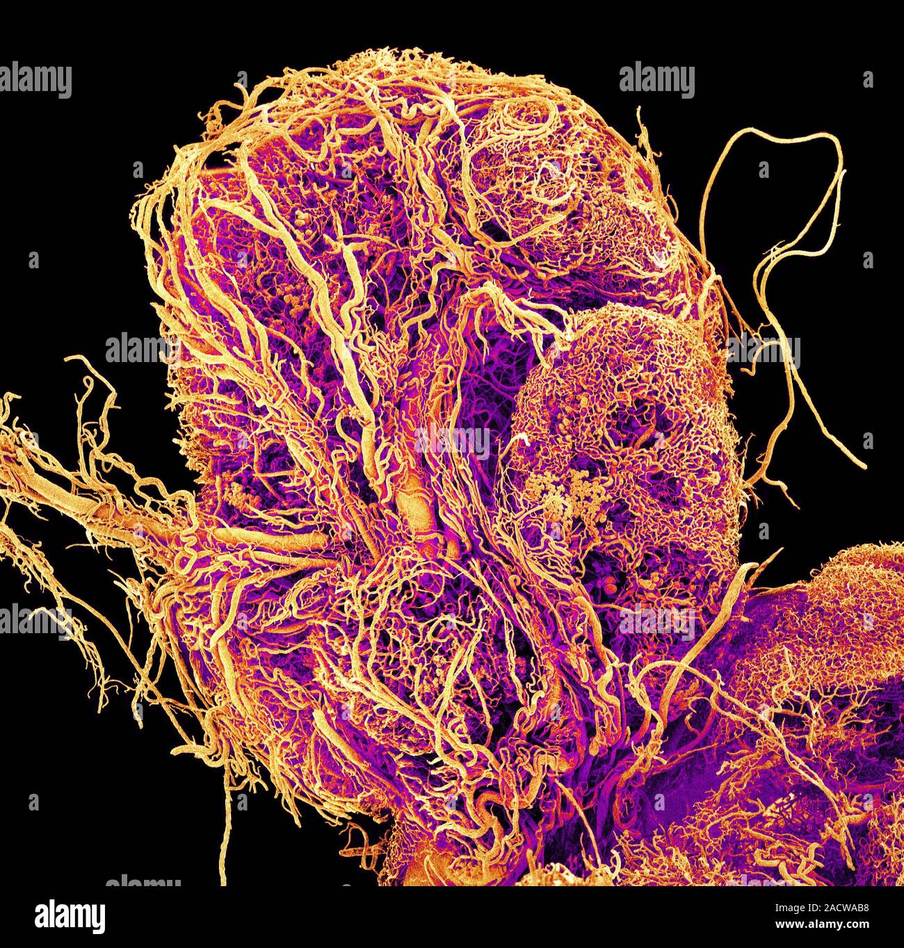 Blood vessels. Coloured scanning electron micrograph (SEM) of a resin ...