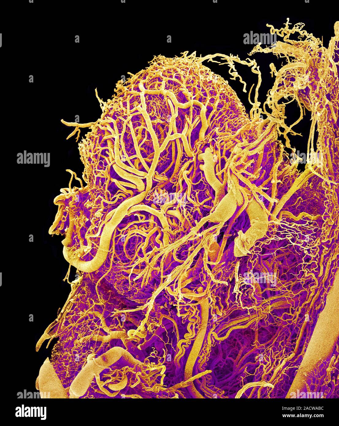 Blood vessels. Coloured scanning electron micrograph (SEM) of a resin ...
