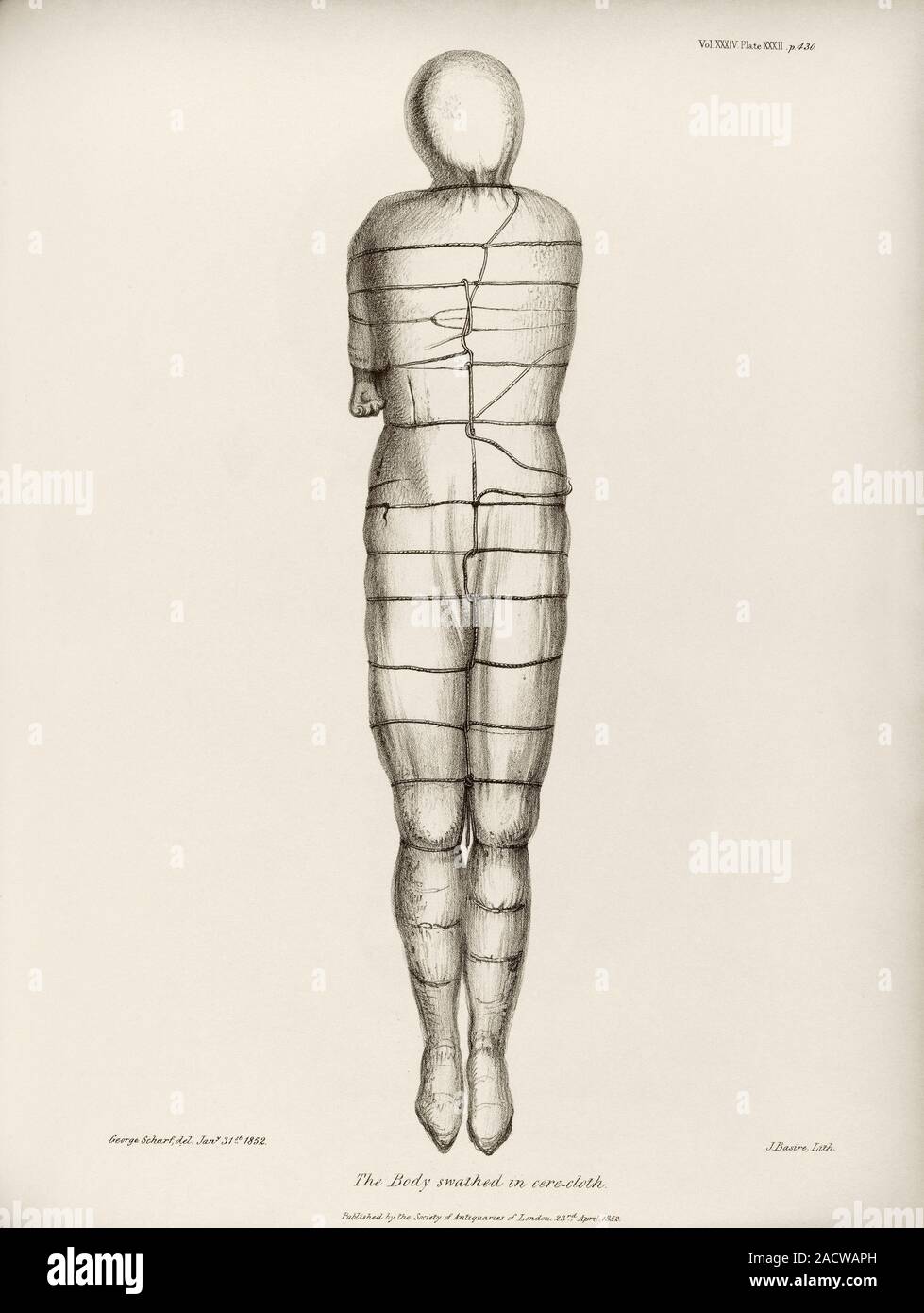 Disinterred 15th-century body. 19th-century artwork of a disinterred ...