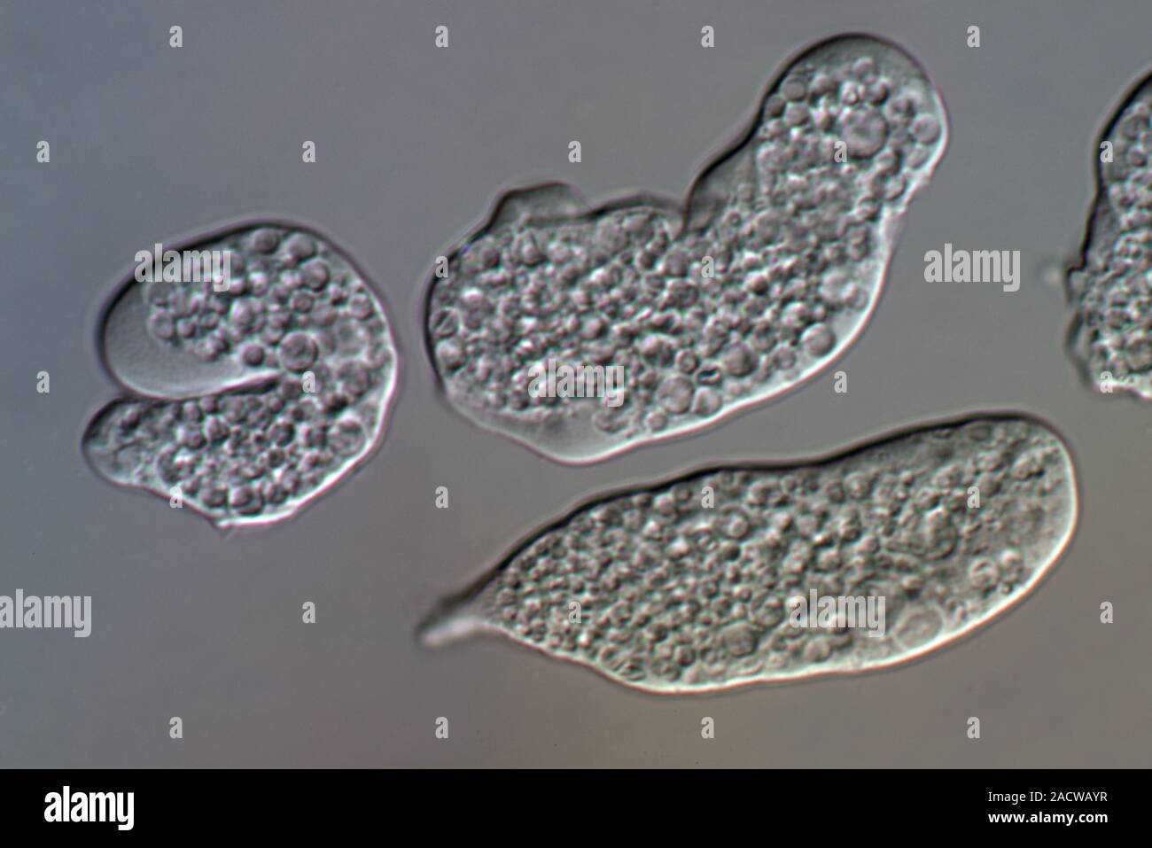 Entamoeba histolytica, differential interference contrast micrograph ...