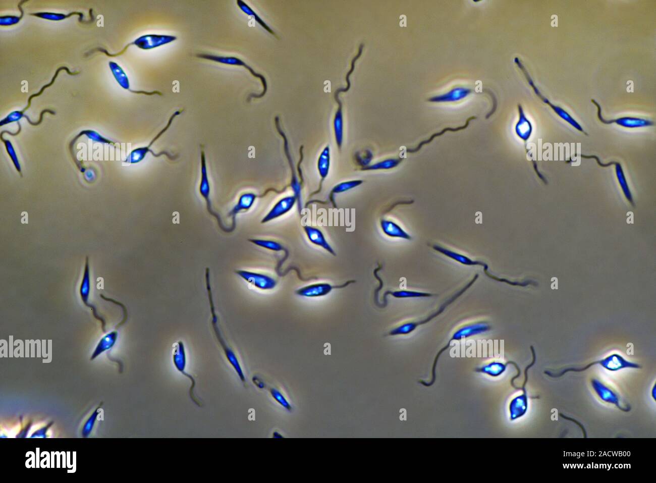 Leishmania parasites. Phase contrast light micrograph of Leishmania ...