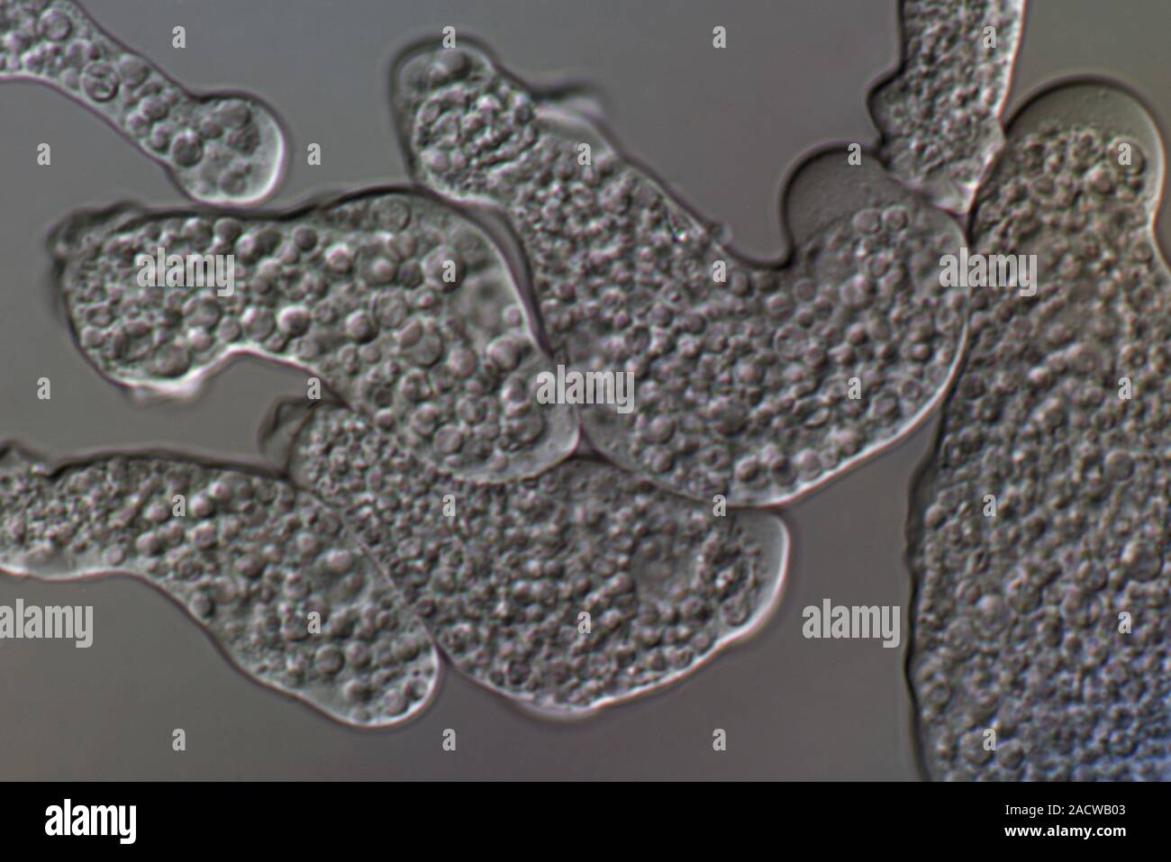 Entamoeba histolytica, differential interference contrast micrograph ...