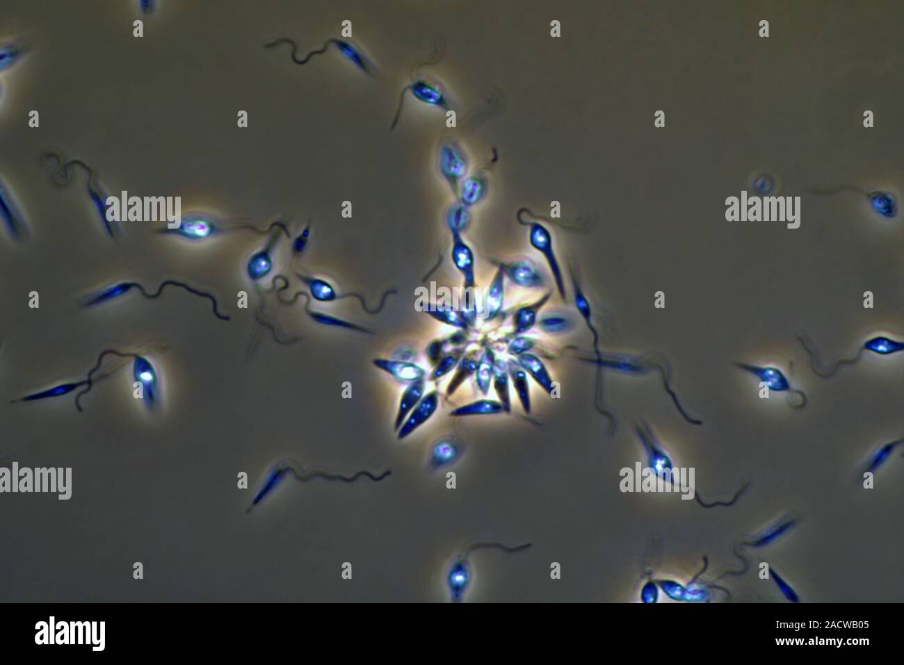Leishmania parasites. Phase contrast light micrograph of Leishmania ...