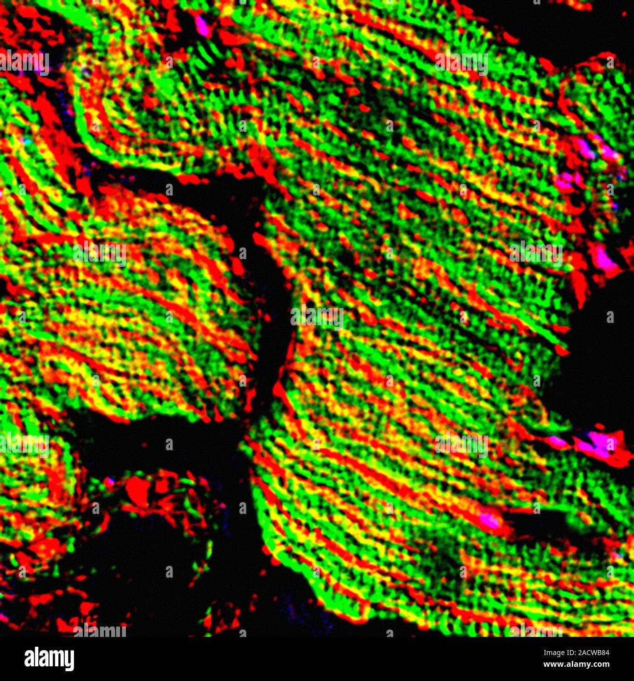Heart muscle. Fluorescence deconvolution micrograph of a section ...