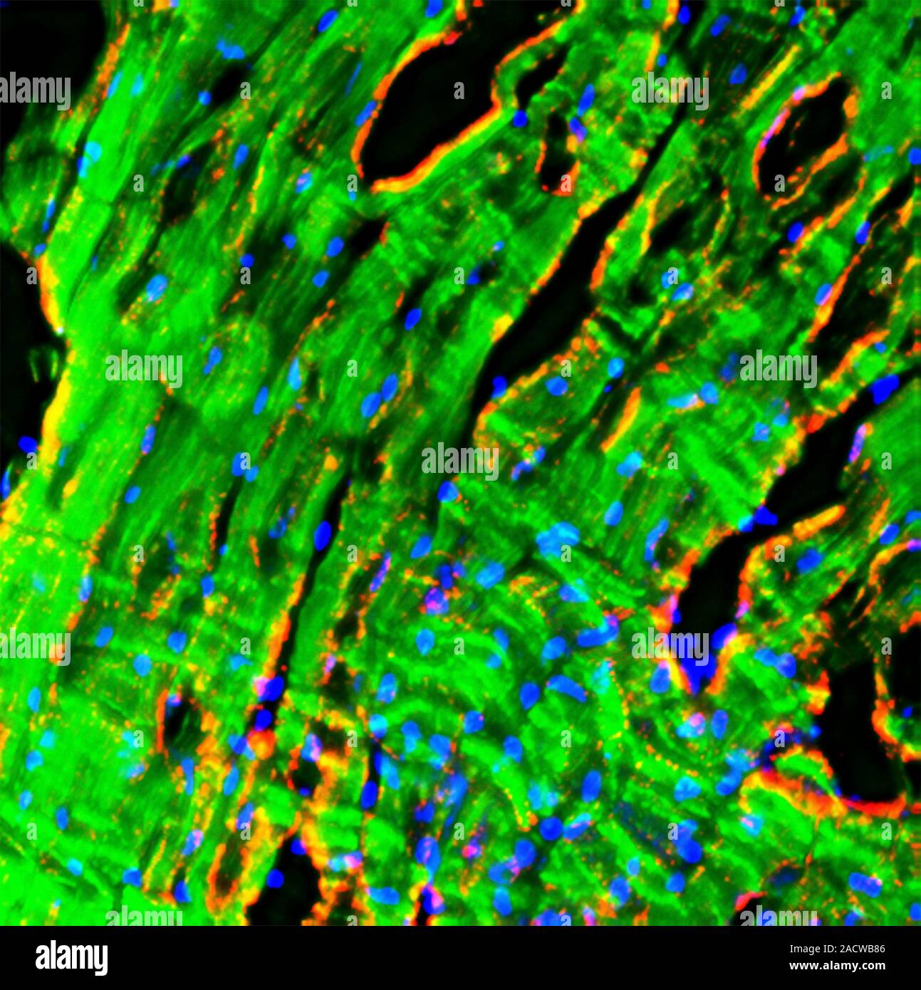 Heart muscle. Fluorescence deconvolution micrograph of a section ...