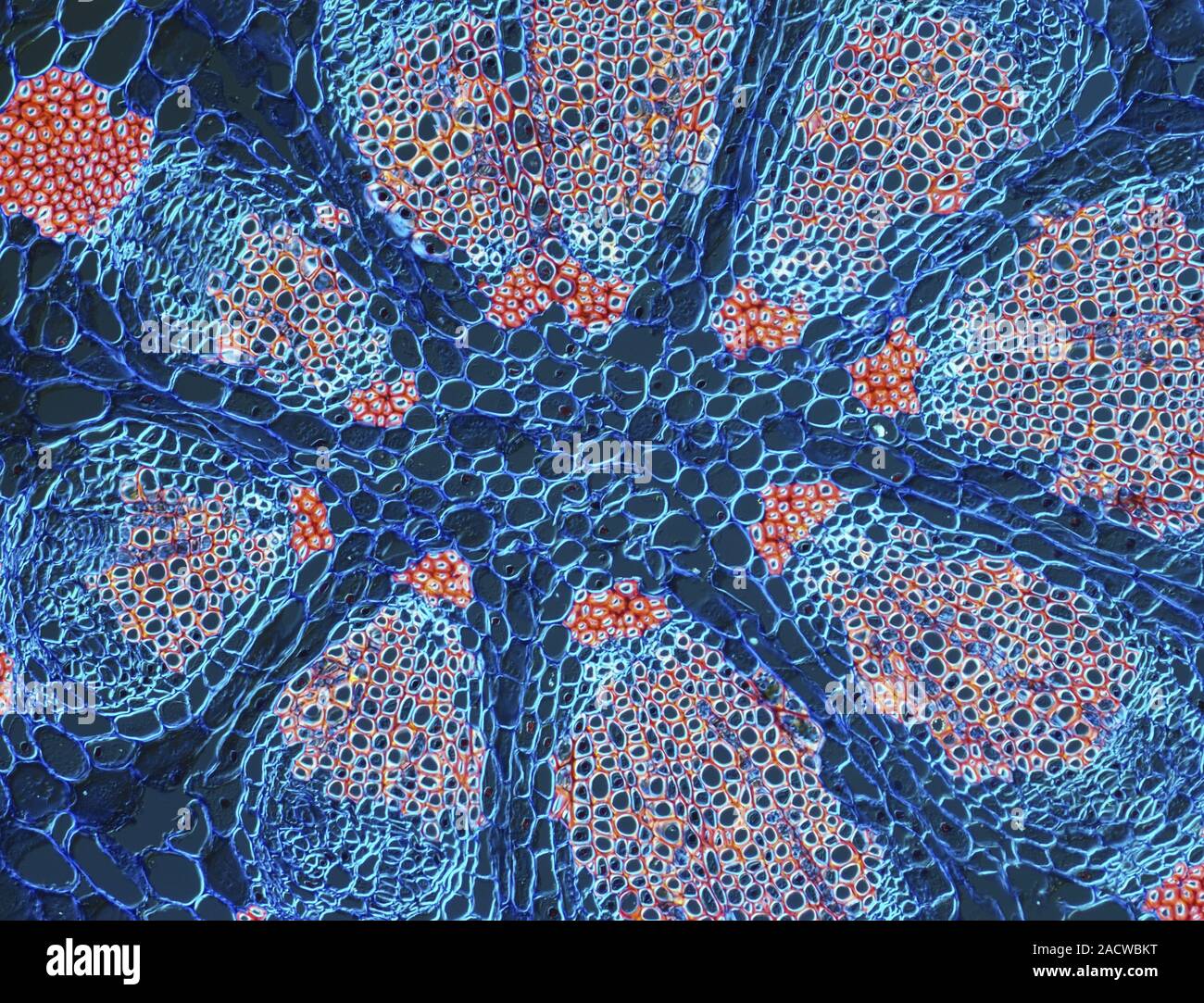 Mistletoe stem.Normarski differential interference contrast (DIC) light ...