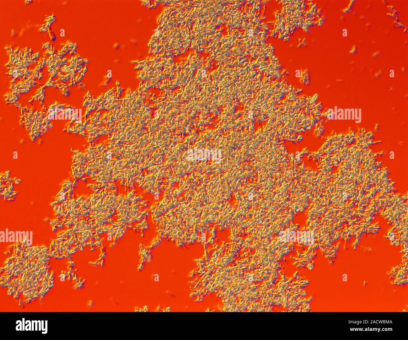 Insulin. Normarski differential interference contrast (DIC) light ...