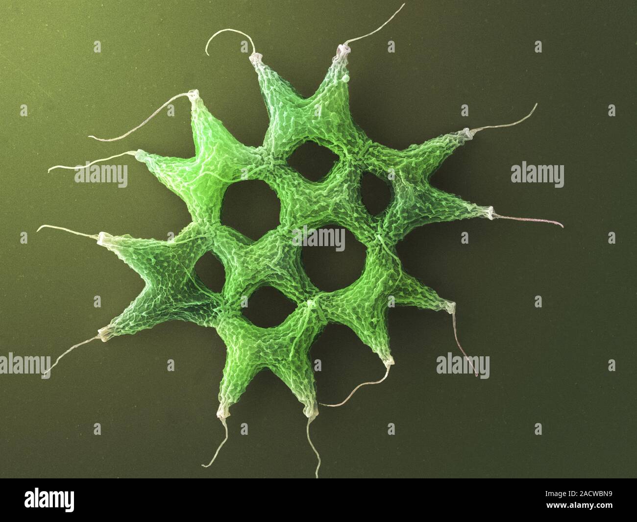 Desmid alga (Pediastrum sp). Scanning electron micrograph (SEM) of the ...
