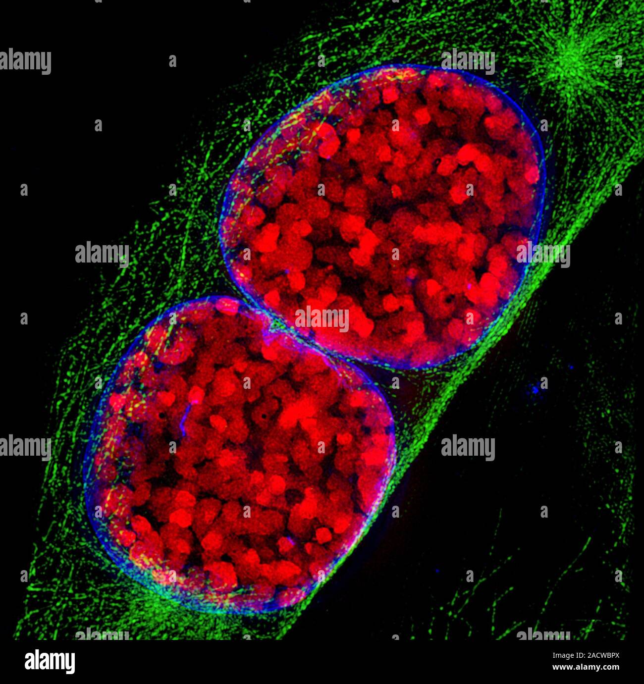 Mitosis 3d Structured Illumination Micrograph 3d Sim Of Two Mouse