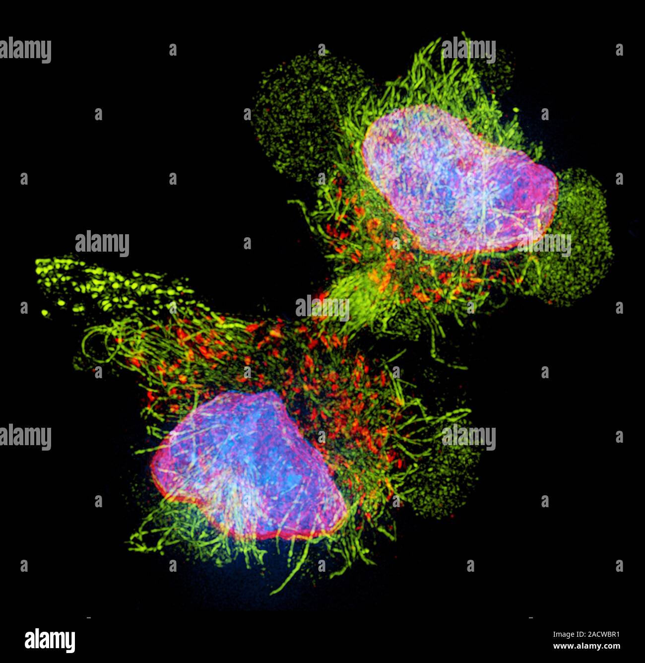 Cell division. 3D-structured illumination micrograph of the nucleus of ...