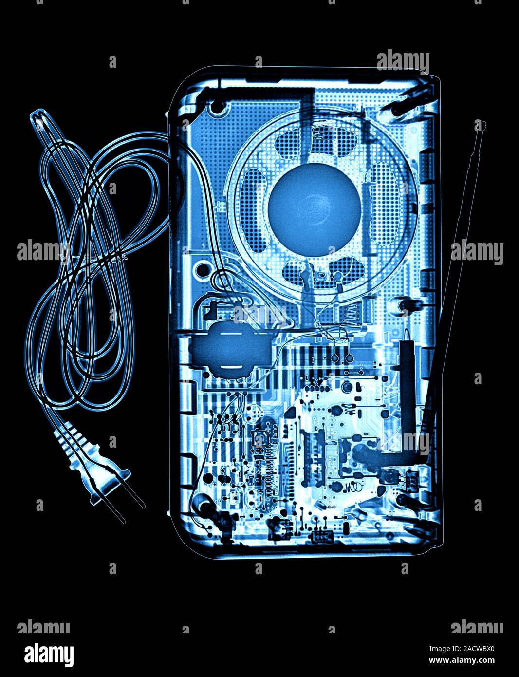 Radio, coloured X-ray Stock Photo - Alamy